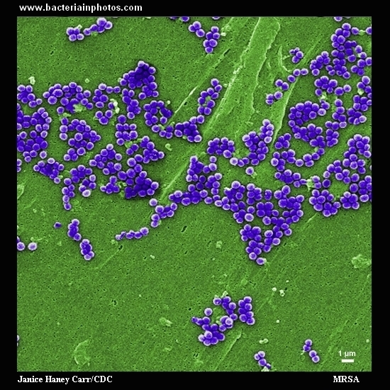 MRSA under microscope (methicillin-resistant Staphylococcus aureus), morphology and microscopic ...